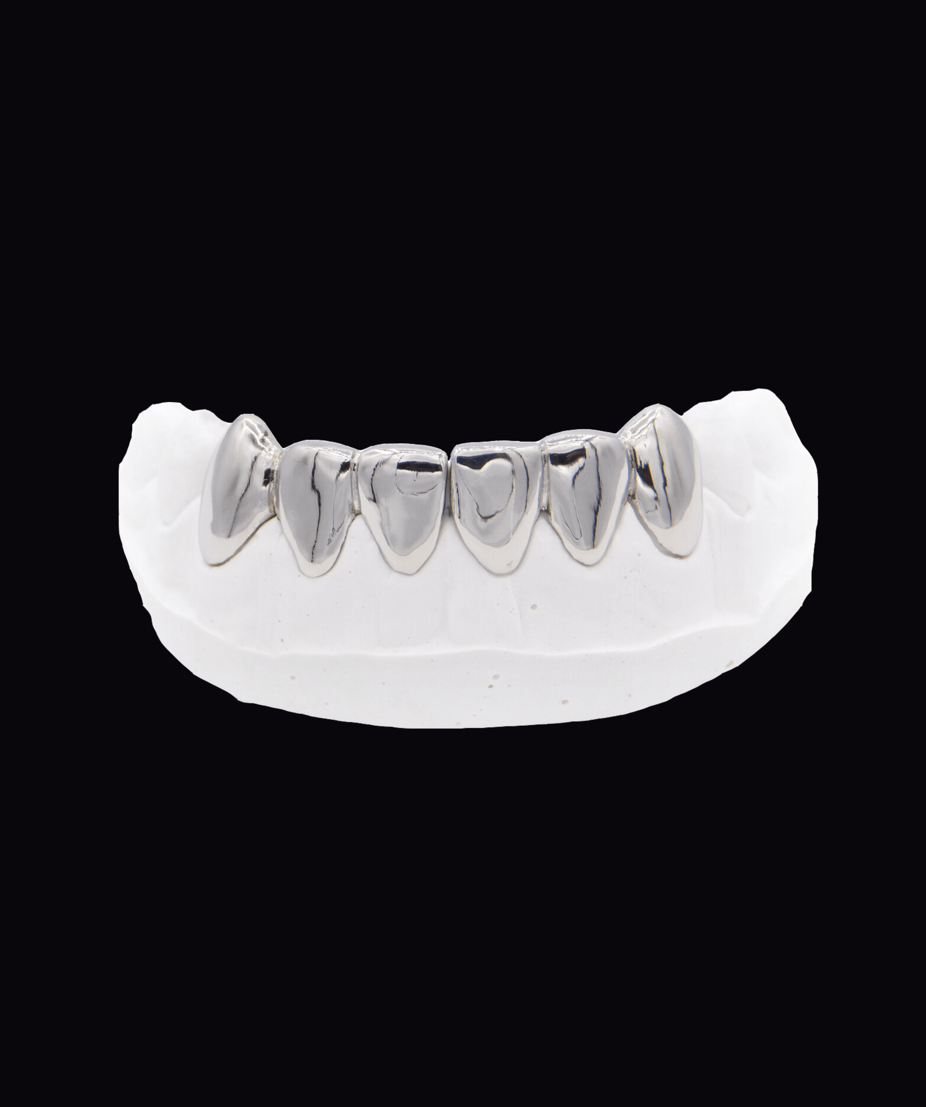 Lower Gold Grillz – ICED LONDON